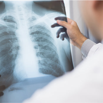 Beyond Breathing Difficulties: The Ripple Effects of Hypercapnia and H ...